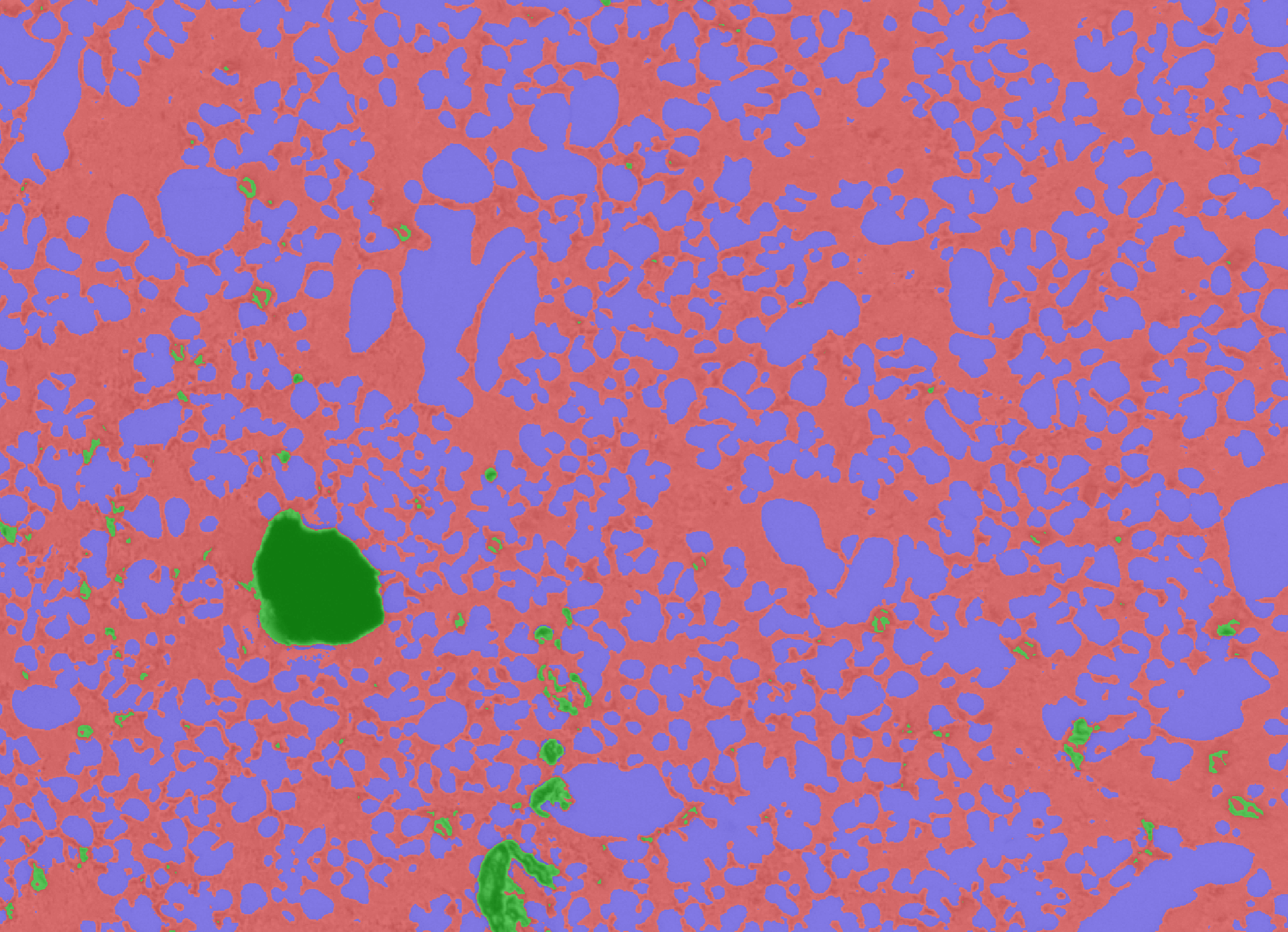 Vereinfachte Bildanalyse für die Mikroskopie mit maschinellem Lernen – Clemex