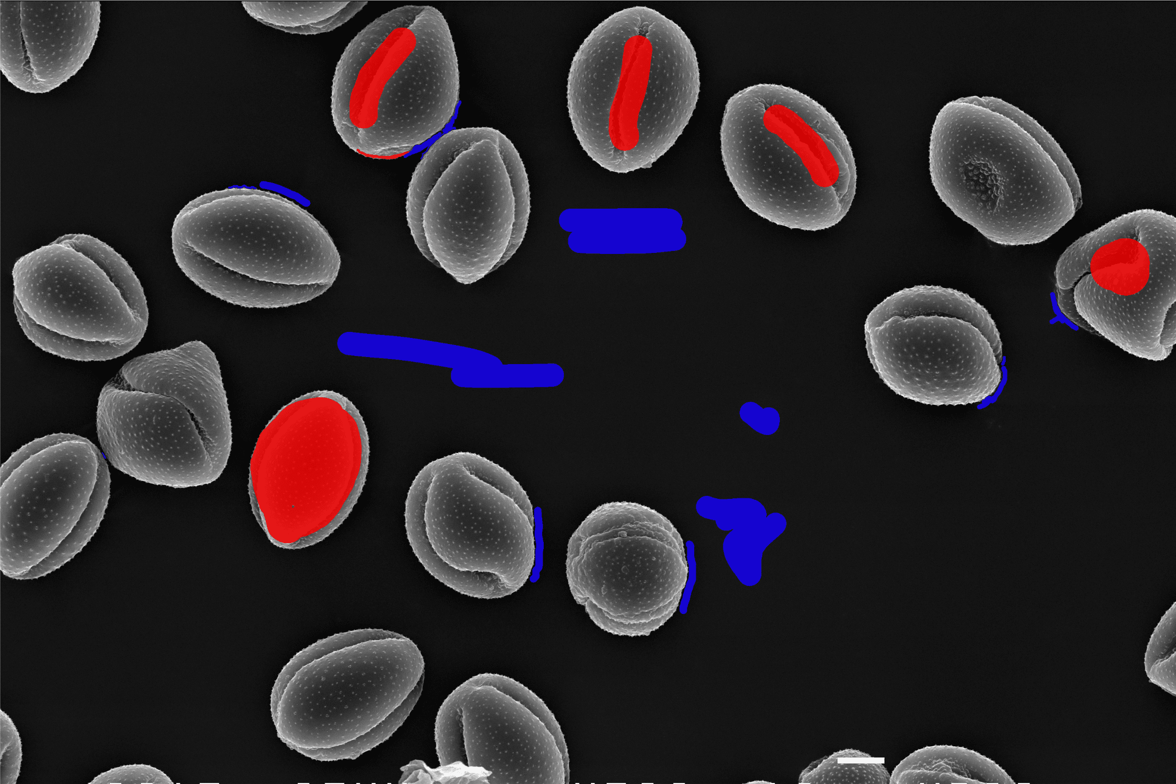 Clemex Studio – Einfache Segmentierung