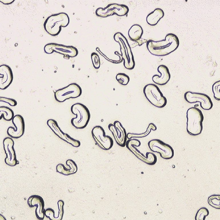 Morphologiecharakterisierung von Baumwollfasern – Clemex